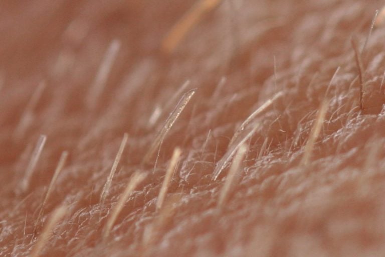 Vellus Hair To Terminal Hair Hair Growth Cycle Guide Hairguard
