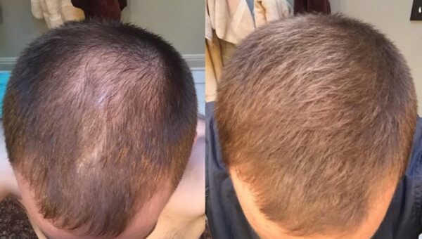 The Toppik Review: Ultimate Guide Before You Buy - Hairguard