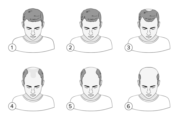 Vellus Hair to Terminal Hair – Hair Growth Cycle Guide - Hairguard
